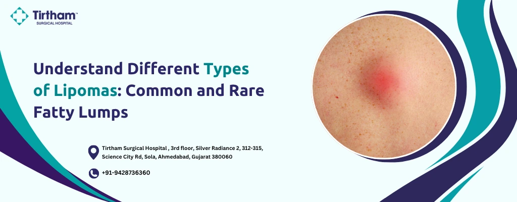 Understand Different Types of Lipomas: Common and Rare Lumps